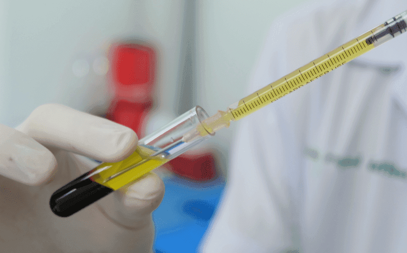 P-Shot Therapy For Sexual Health Naturally: Dot clinics